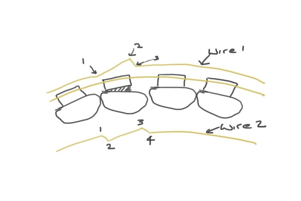 Introduction in to wire bending to finish orthodontic cases - Dr Gurs Sehmi