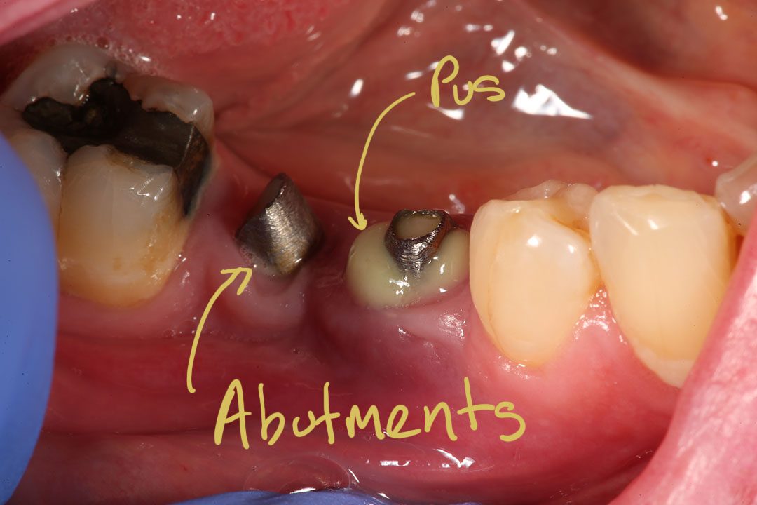 Annotated Pus Diagram - Dr Gurs Sehmi